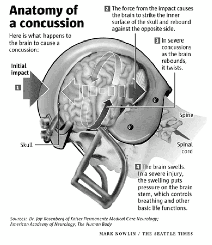 Brain Injuries On and Off the Football Field